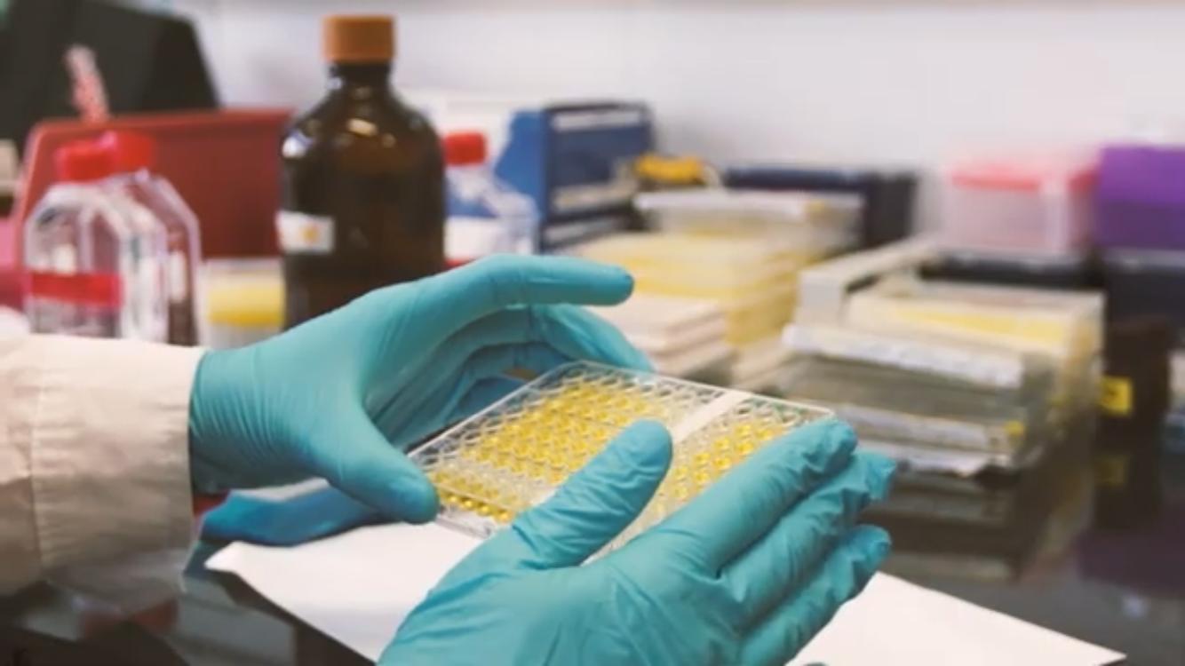 Tests serológicos para el diagnóstico de Covid-19